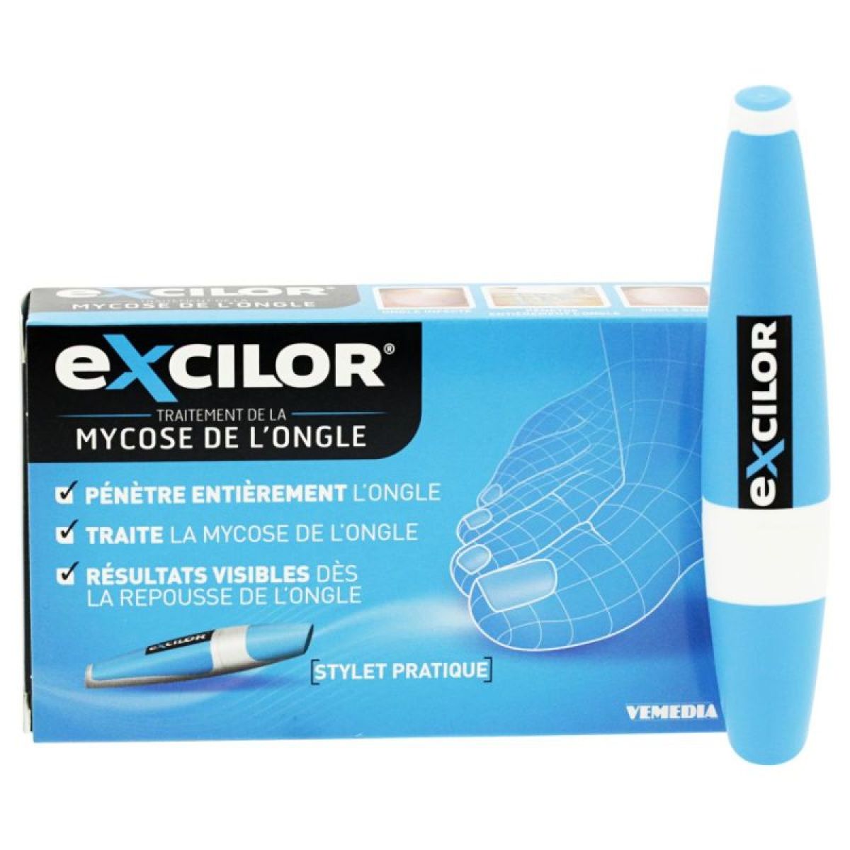 Excilor Mycose Ongle : traitement stylisé pour mycoses